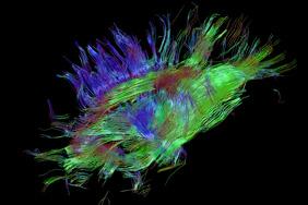 New Three Dimensional Nerve Maps of MRI Brain Scans