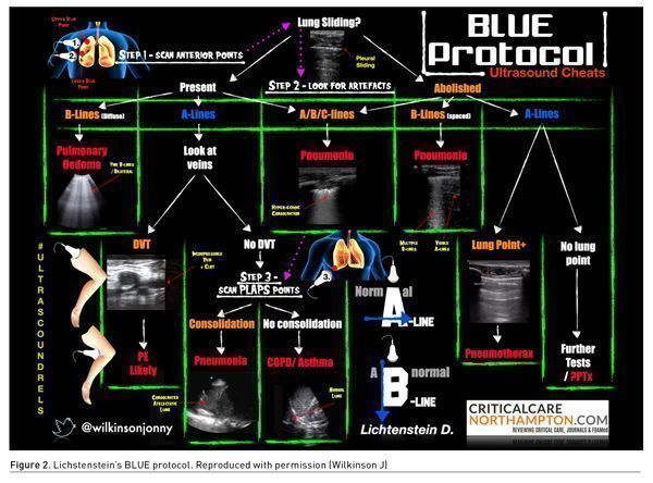 Point of Care Ultrasound: The Critical Imaging Tool for the Critically ...