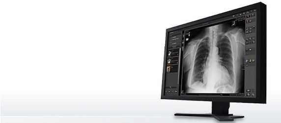 Carestream’s Newest Mini-PACS Software Improves DR Imaging Systems