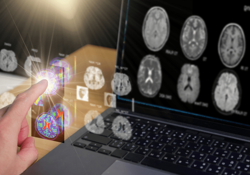 Versatile and Accurate DL Model for Amyloid Positivity Prediction in ...