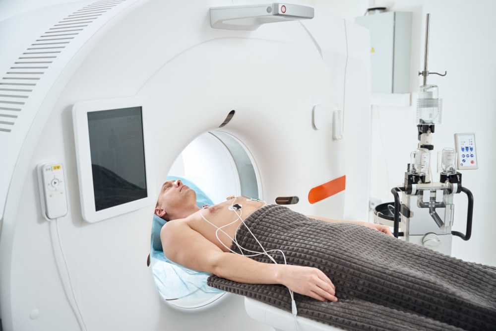 The Dual Benefits of Lung Cancer Screening: A Cardiovascular Perspective