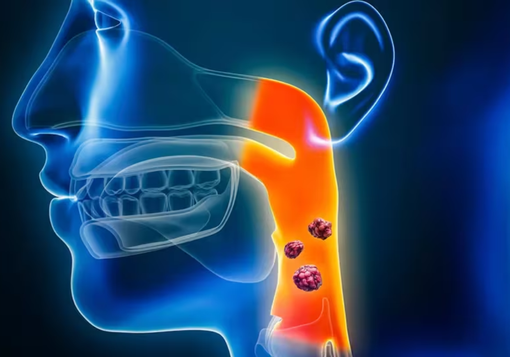 Predicting Early Response in Nasopharyngeal Cancer with MRI