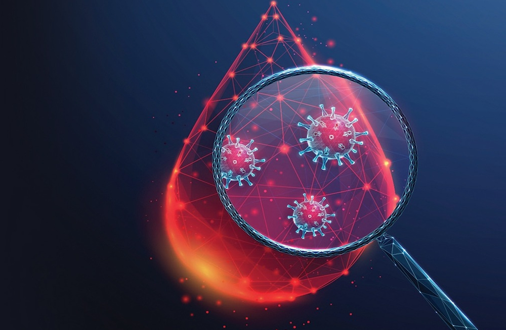 Redefining Sepsis Through Host–Microbe Dynamics