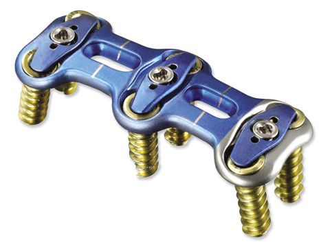 Promoting Management and Leadership - HealthManagement.org | Cervical ...