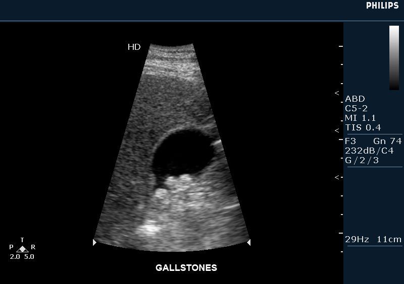 Promoting Management and Leadership - HealthManagement.org | Ultrasound ...
